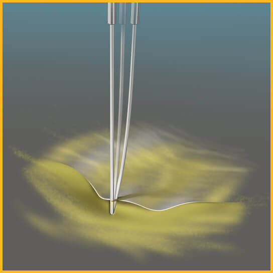 Shallow Water Anchor Buying Guide - Minn Kota